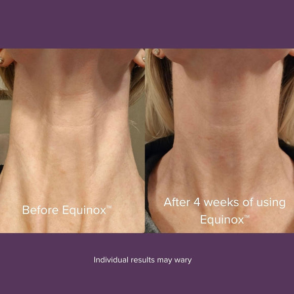 Equinox™ Pro LED Mask - Lights On, Problems Off – Luyors